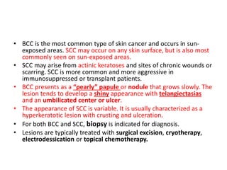 Skin cancer | PPTX
