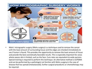 Skin cancer | PPTX