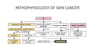 Skin cancer | PPTX