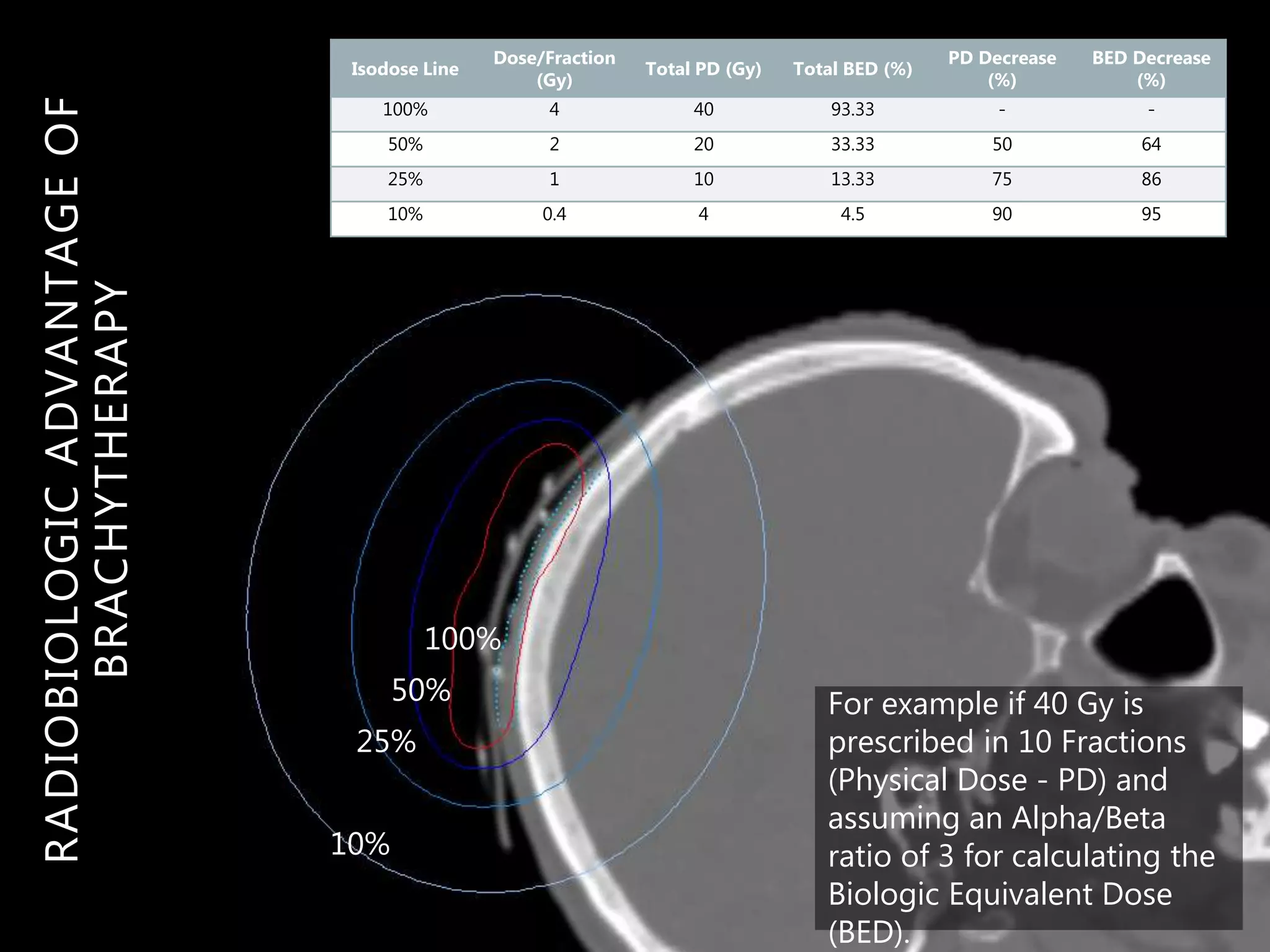 HDR brachytherapy for Non-Melanoma Skin cancers | PPTX