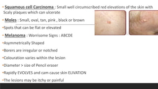 Skin Cancer | PPTX