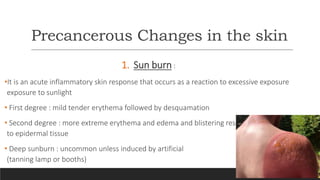 Skin Cancer | PPTX