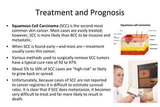 Skin Cancer 2018 | PPTX