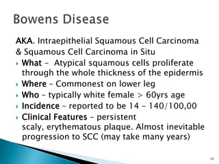 Skin Cancer And The Lower Limb | PPT