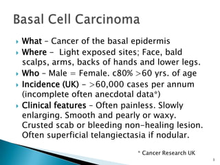 Skin Cancer And The Lower Limb | PPT