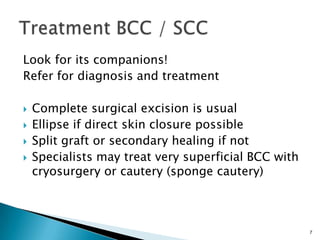 Skin Cancer And The Lower Limb | PPT