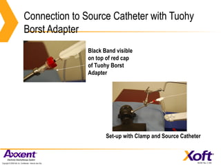Skin cancer applicators ppp | PPT