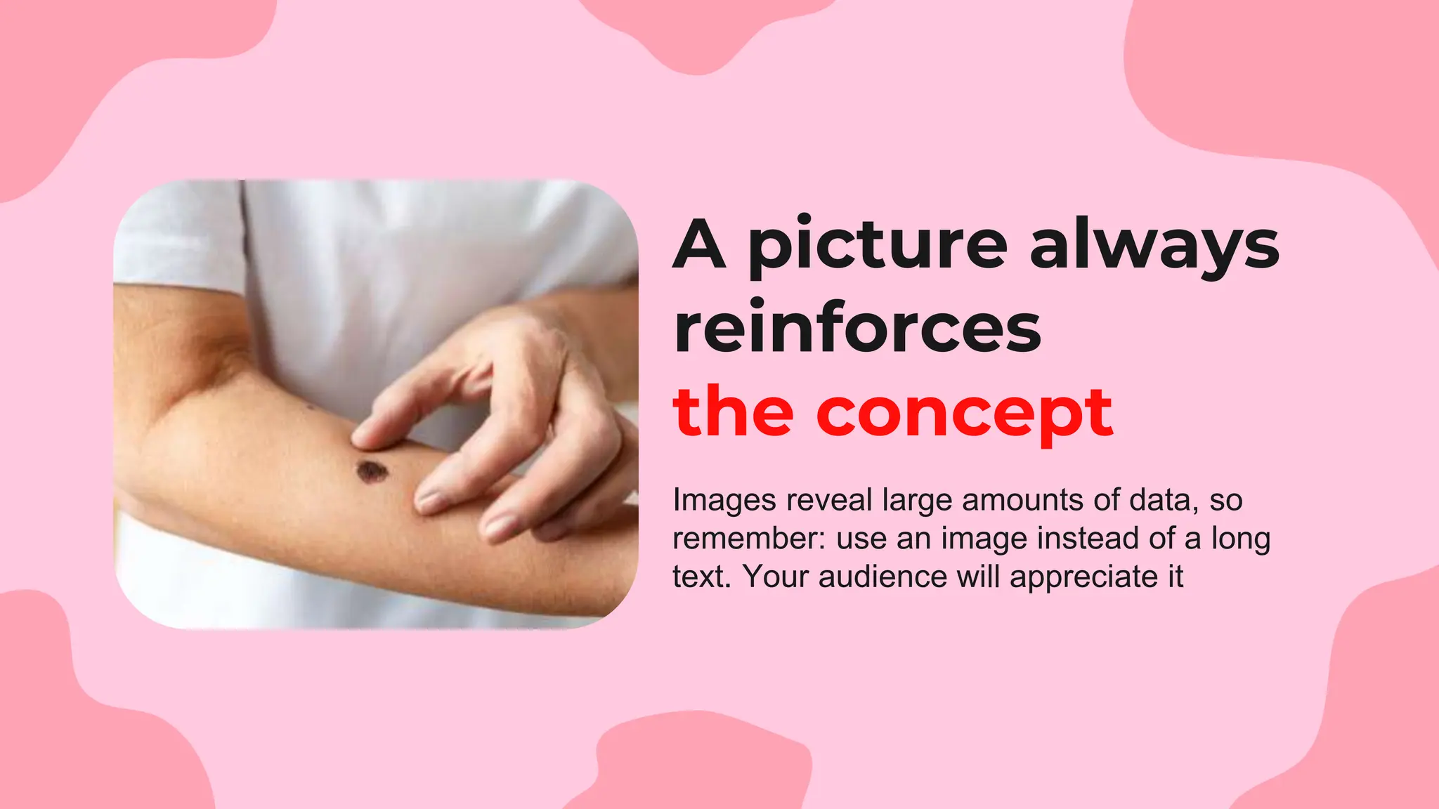 Skin Cancer Disease by Slidesgo dermatologia.pptx