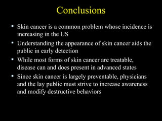 Early Detection of Melanoma and Other Skin Cancers | PPT