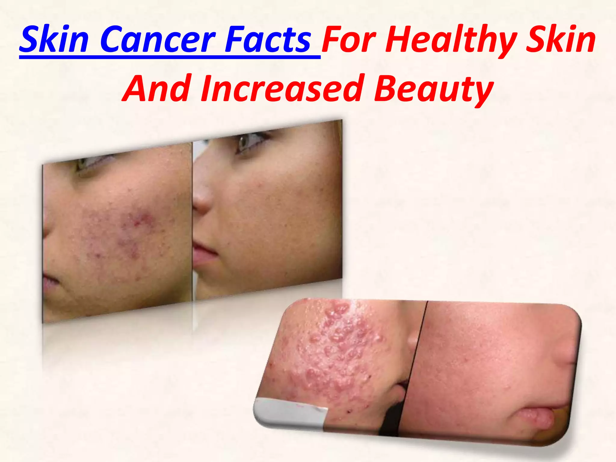 Skin cancer facts blog | PPTX