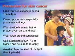 Skin cancer power point | PPTX