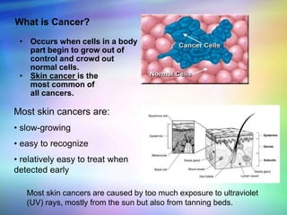 Skin cancer power point | PPTX