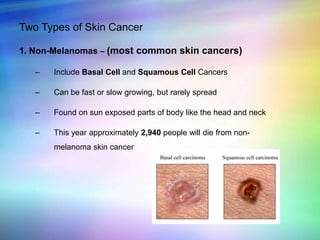 Skin cancer power point | PPTX