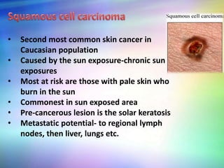 Skin cancer power point | PPTX