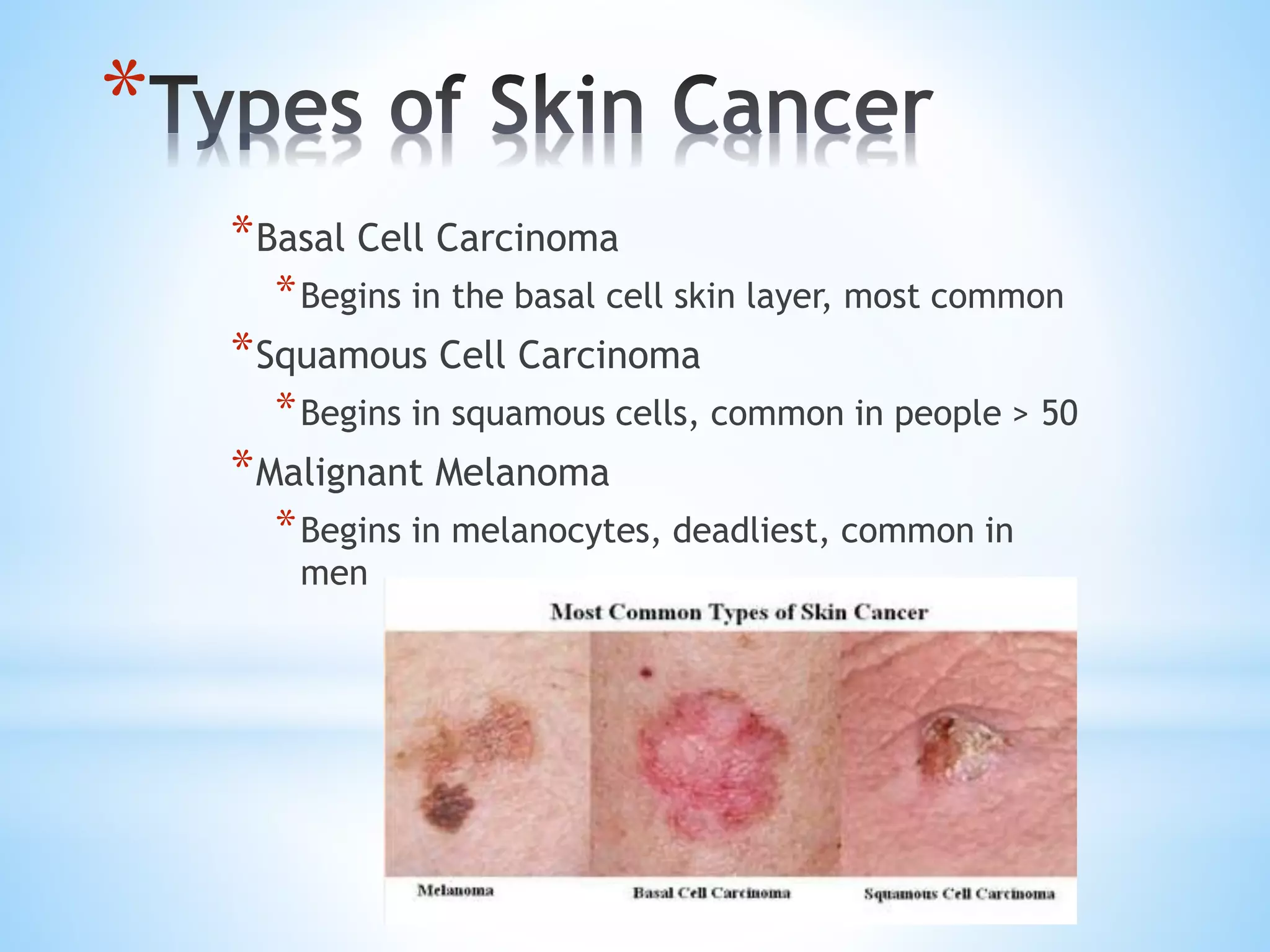 Skin cancer pp | PPTX