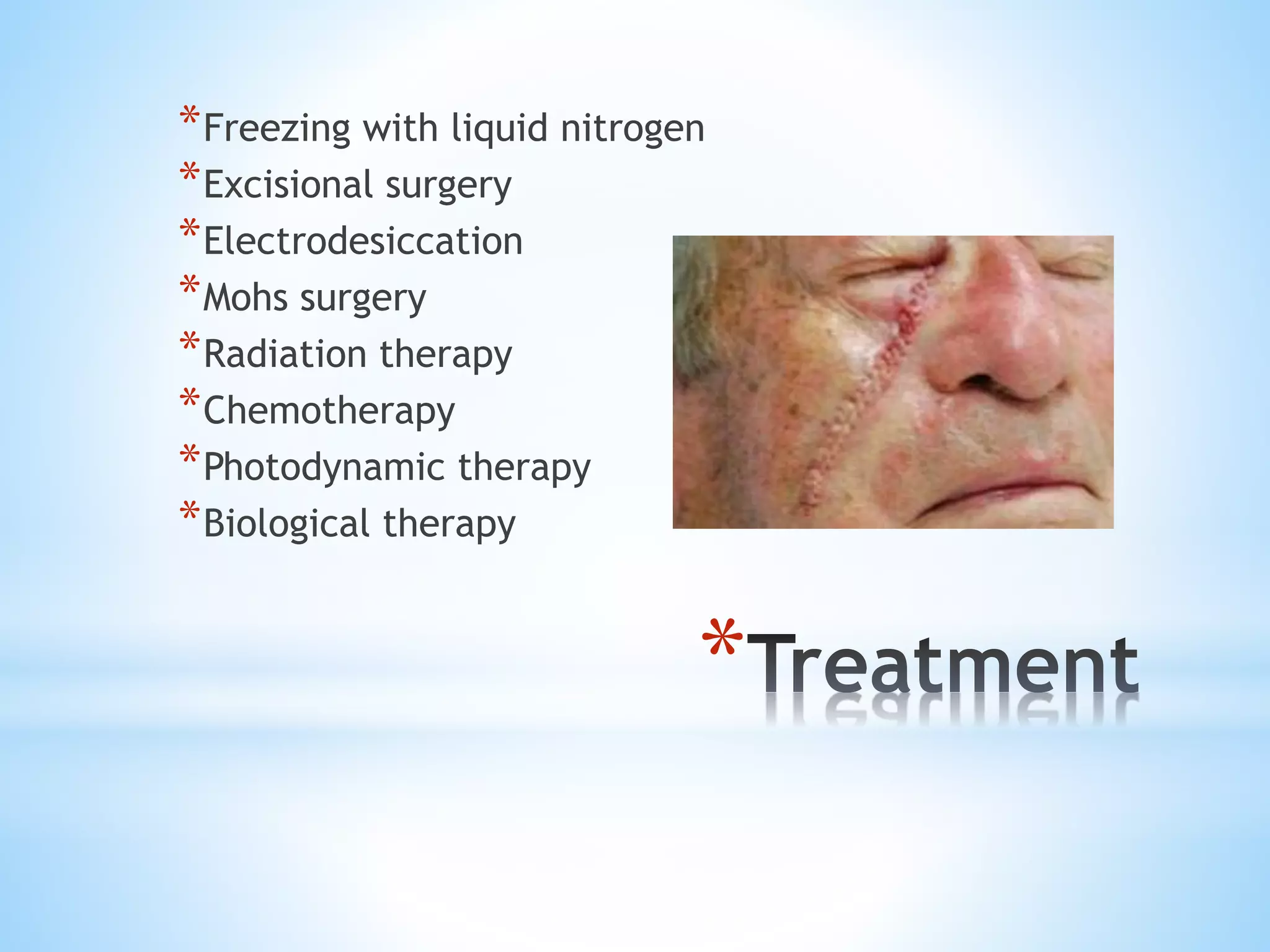 Skin cancer pp | PPTX