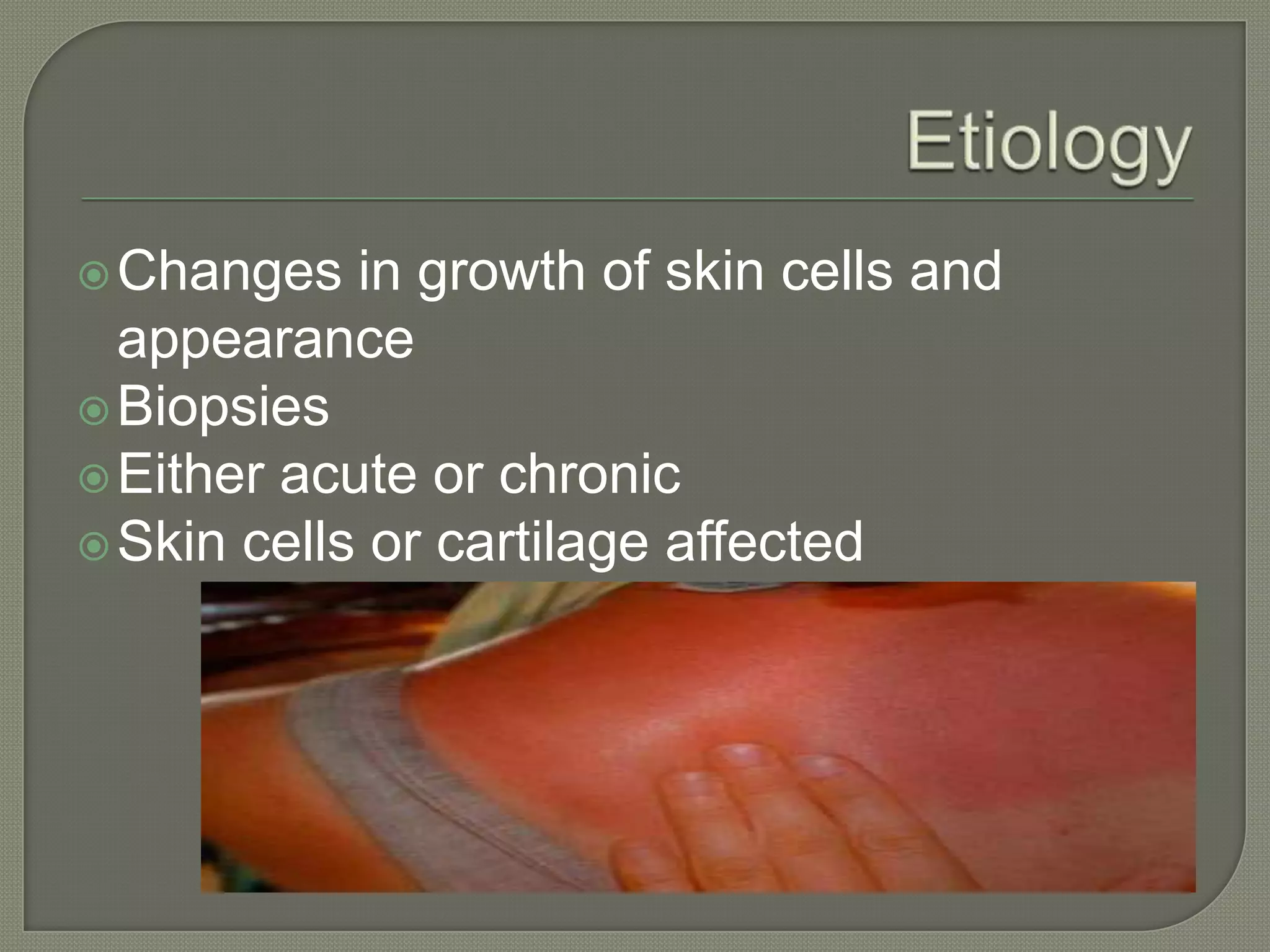 Skin Cancer P P T | PPTX