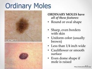 SKIN CANCER - BUGEMA UNIVERSITY. | PPT