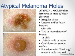 SKIN CANCER - BUGEMA UNIVERSITY. | PPT