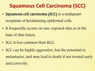 Skin cancers | PPTX