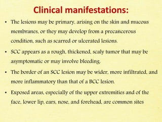 Skin Cancer disease detailed review and information | PPT