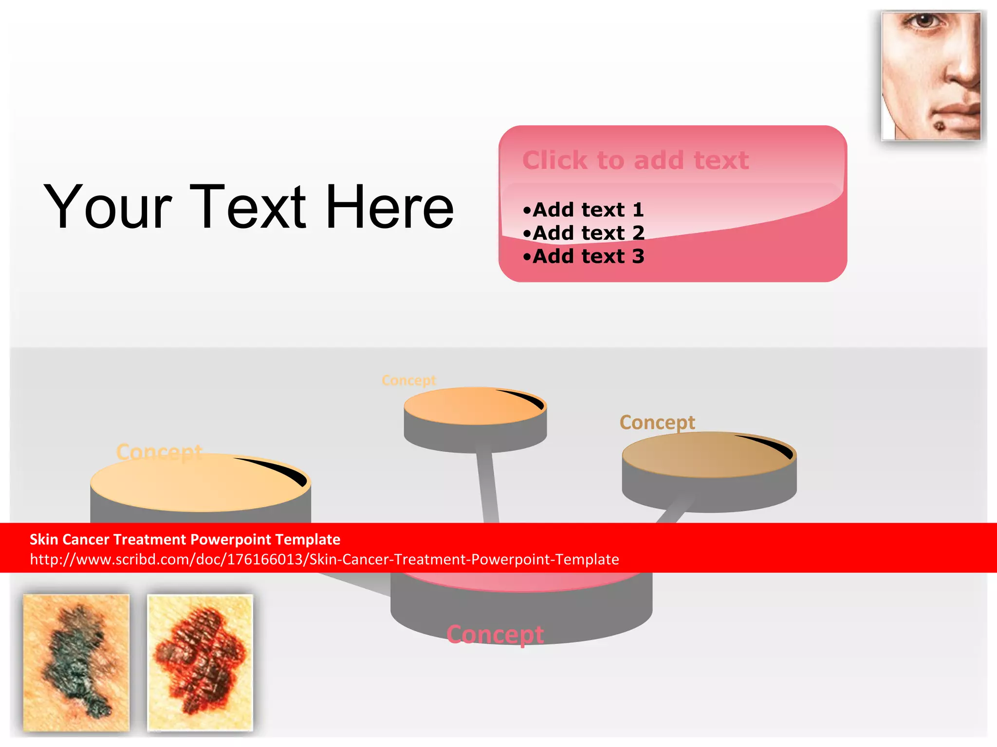 Skin Cancer Treatment Powerpoint Template | PPT