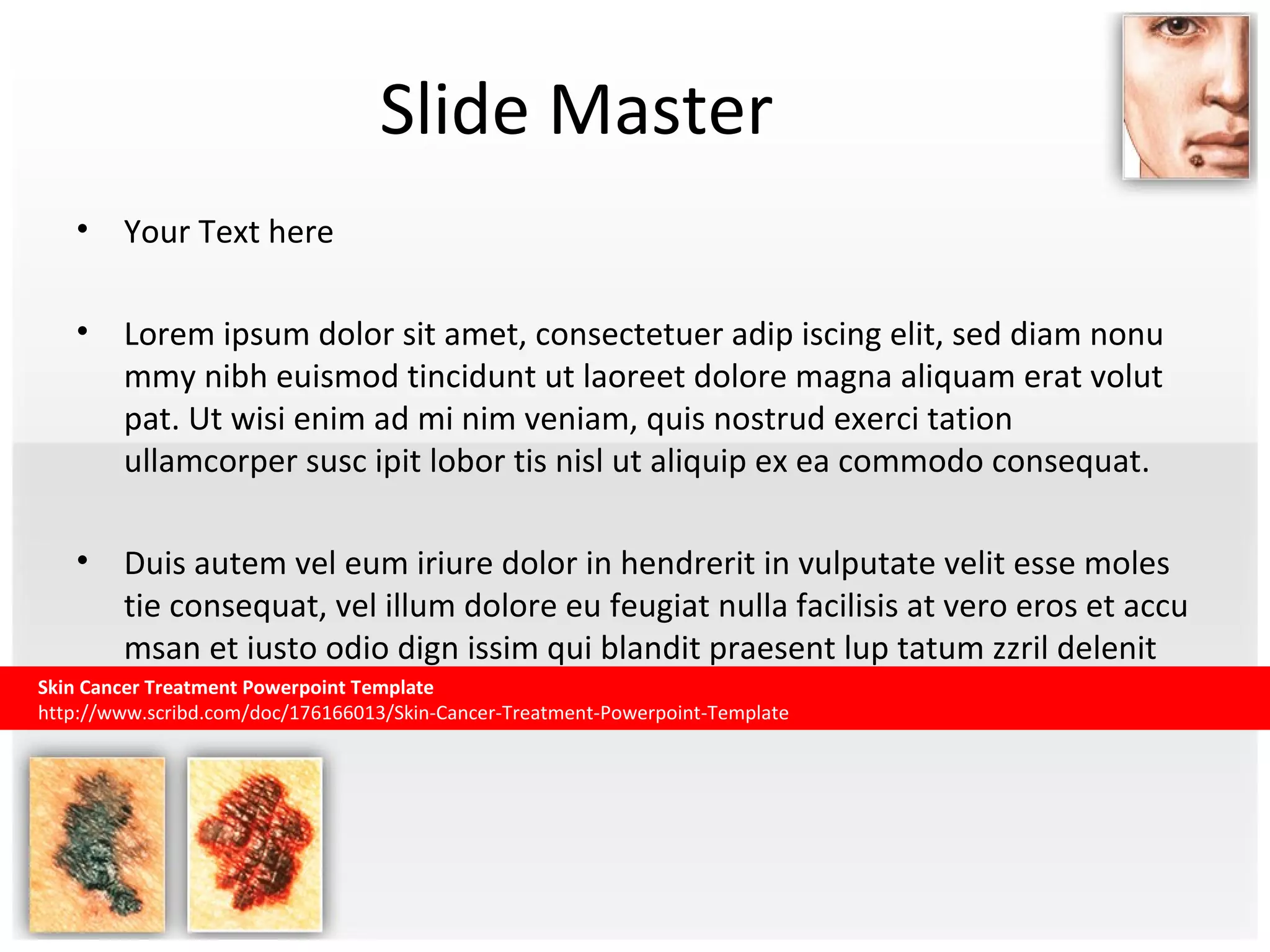 Skin Cancer Treatment Powerpoint Template | PPT