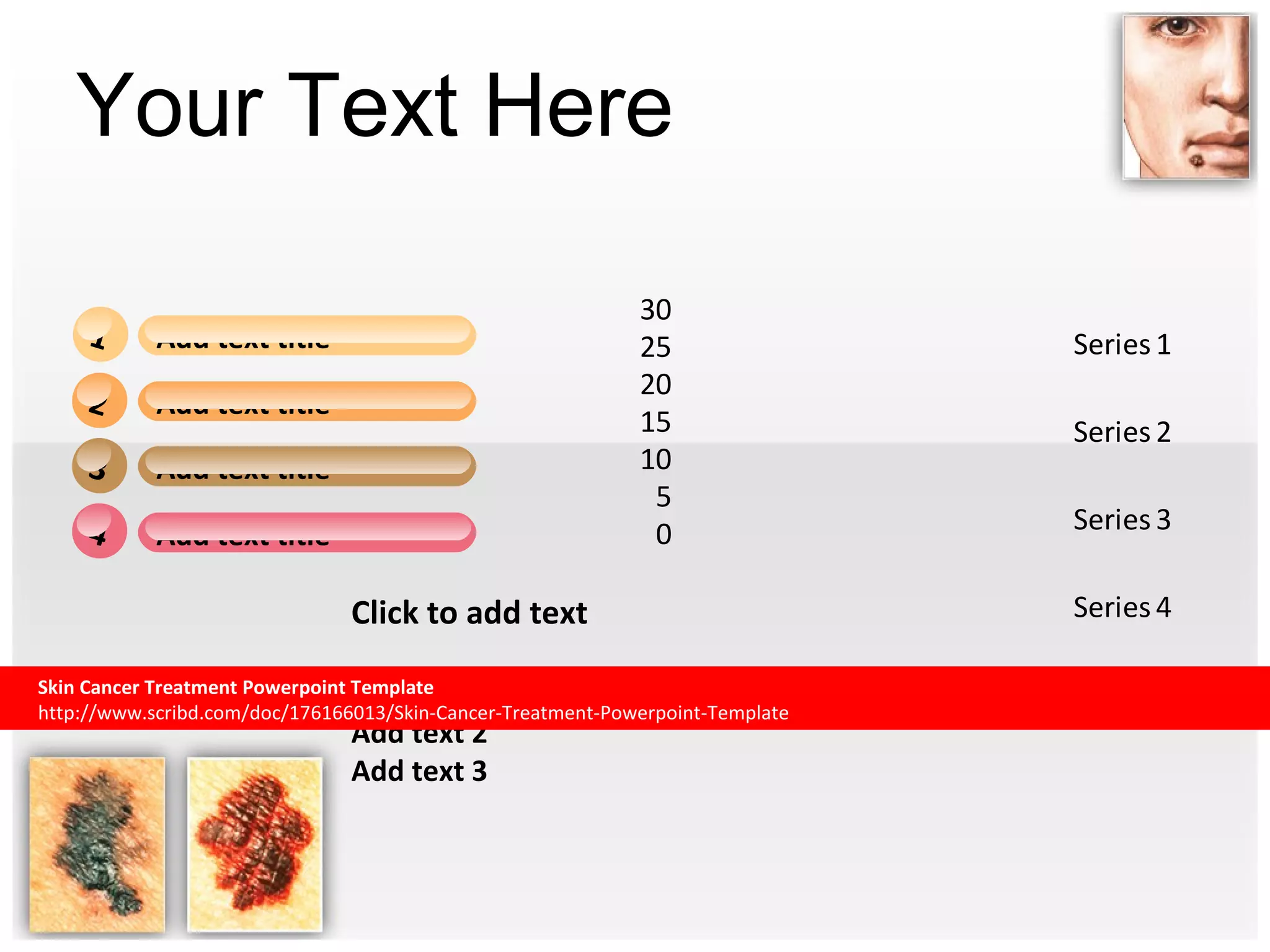 Skin Cancer Treatment Powerpoint Template | PPT