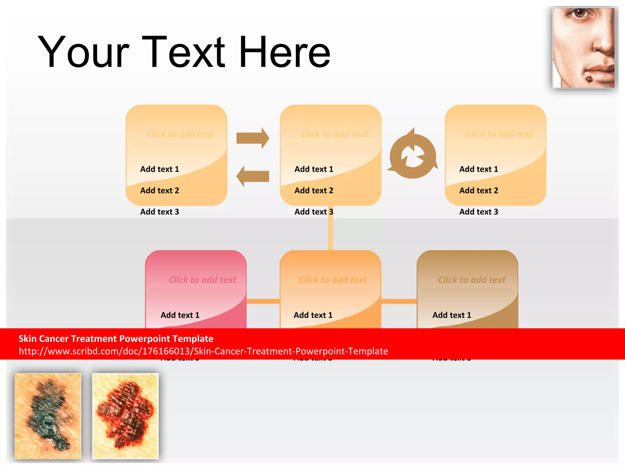 Skin Cancer Treatment Powerpoint Template | PPT