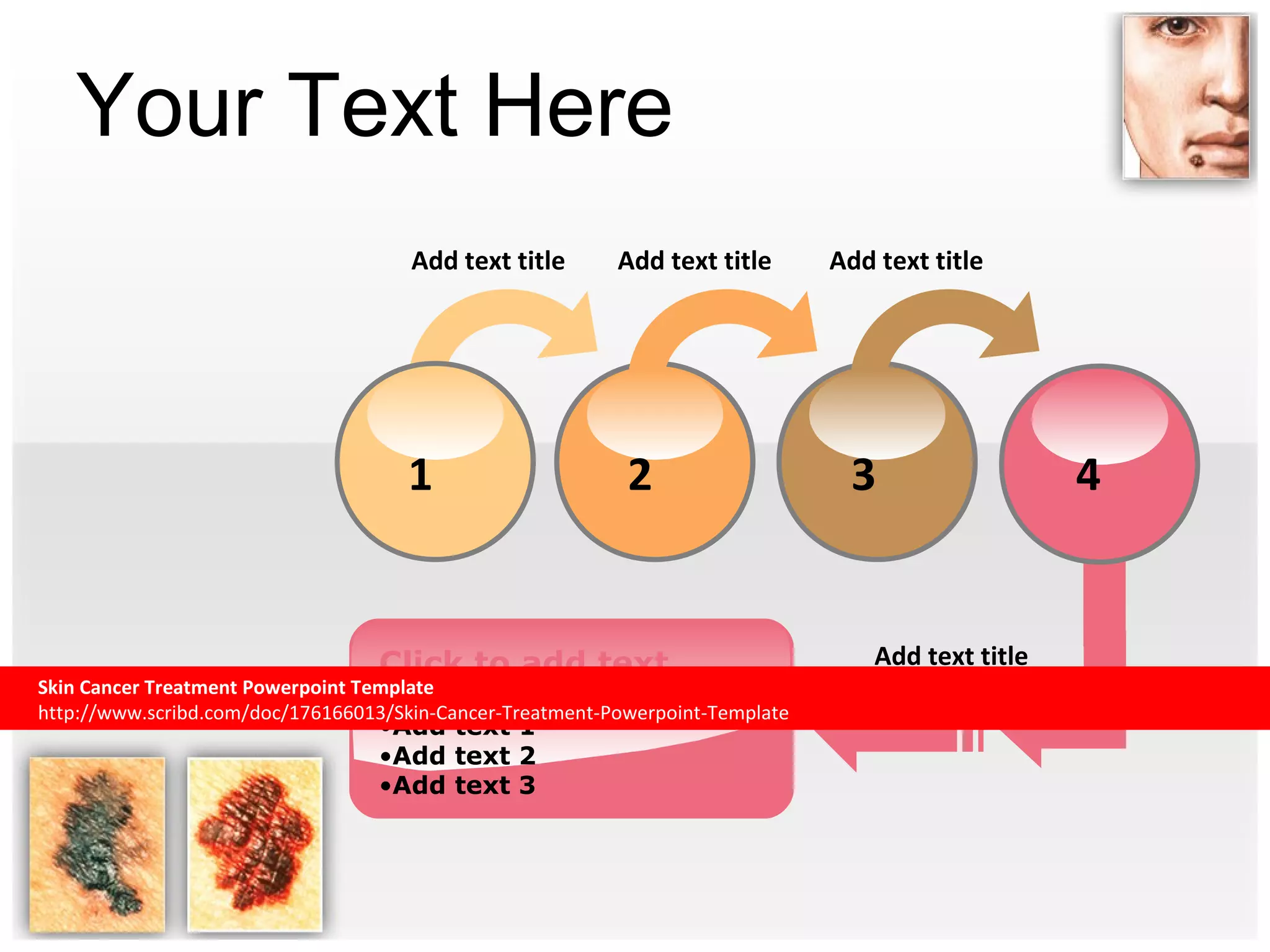 Skin Cancer Treatment Powerpoint Template | PPT