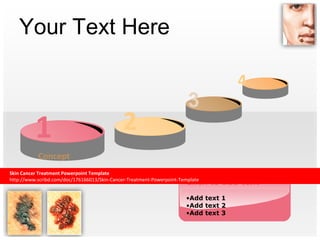 Skin Cancer Treatment Powerpoint Template | PPT