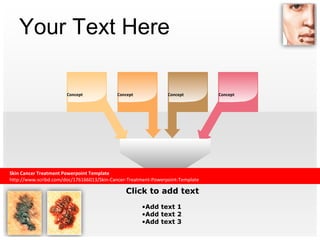 Skin Cancer Treatment Powerpoint Template | PPT