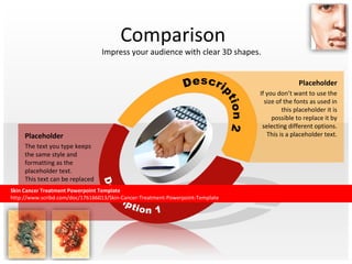 Skin Cancer Treatment Powerpoint Template | PPT