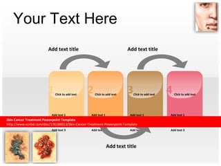 Skin Cancer Treatment Powerpoint Template | PPT