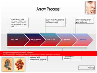 Skin Cancer Treatment Powerpoint Template | PPT
