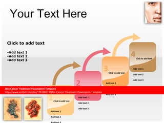Skin Cancer Treatment Powerpoint Template | PPT
