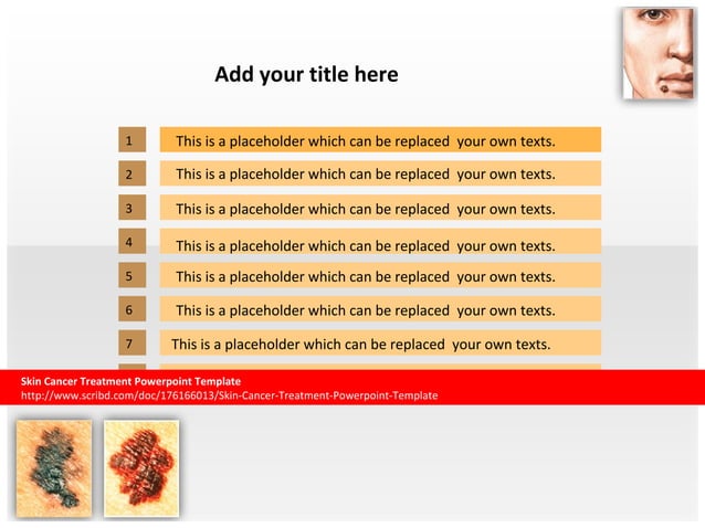 Skin Cancer Treatment Powerpoint Template | PPT | Desktop Publishing ...