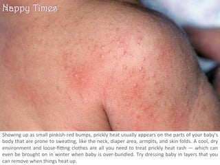 Skin care for Babies | PDF