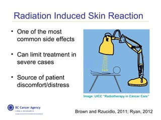 Skin care for radiotherapy | PPT