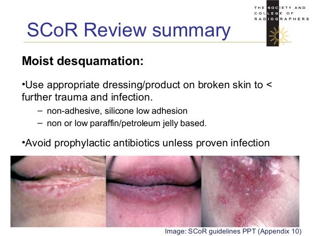 Skin care for radiotherapy