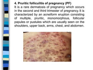 Skin changes and diseases in pregnancy | PPTX