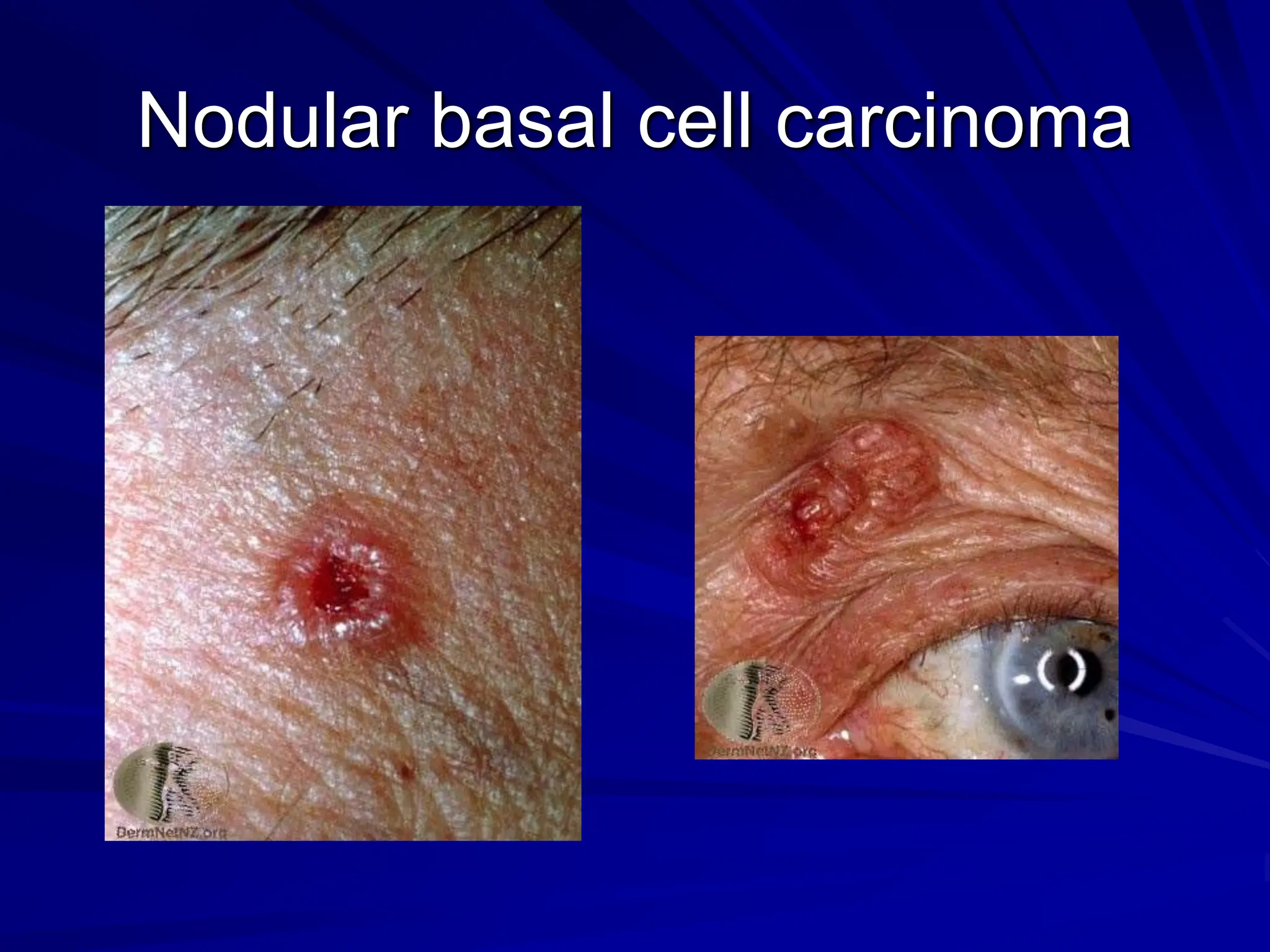 skin conditions with normal skin anatomy and physiology. | PPT