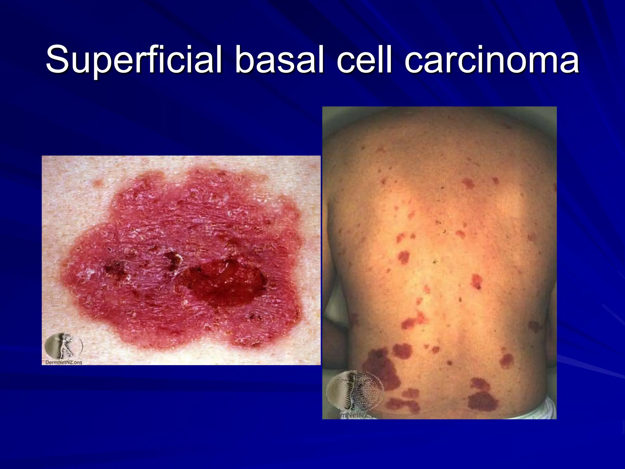 skin conditions with normal skin anatomy and physiology. | PPT