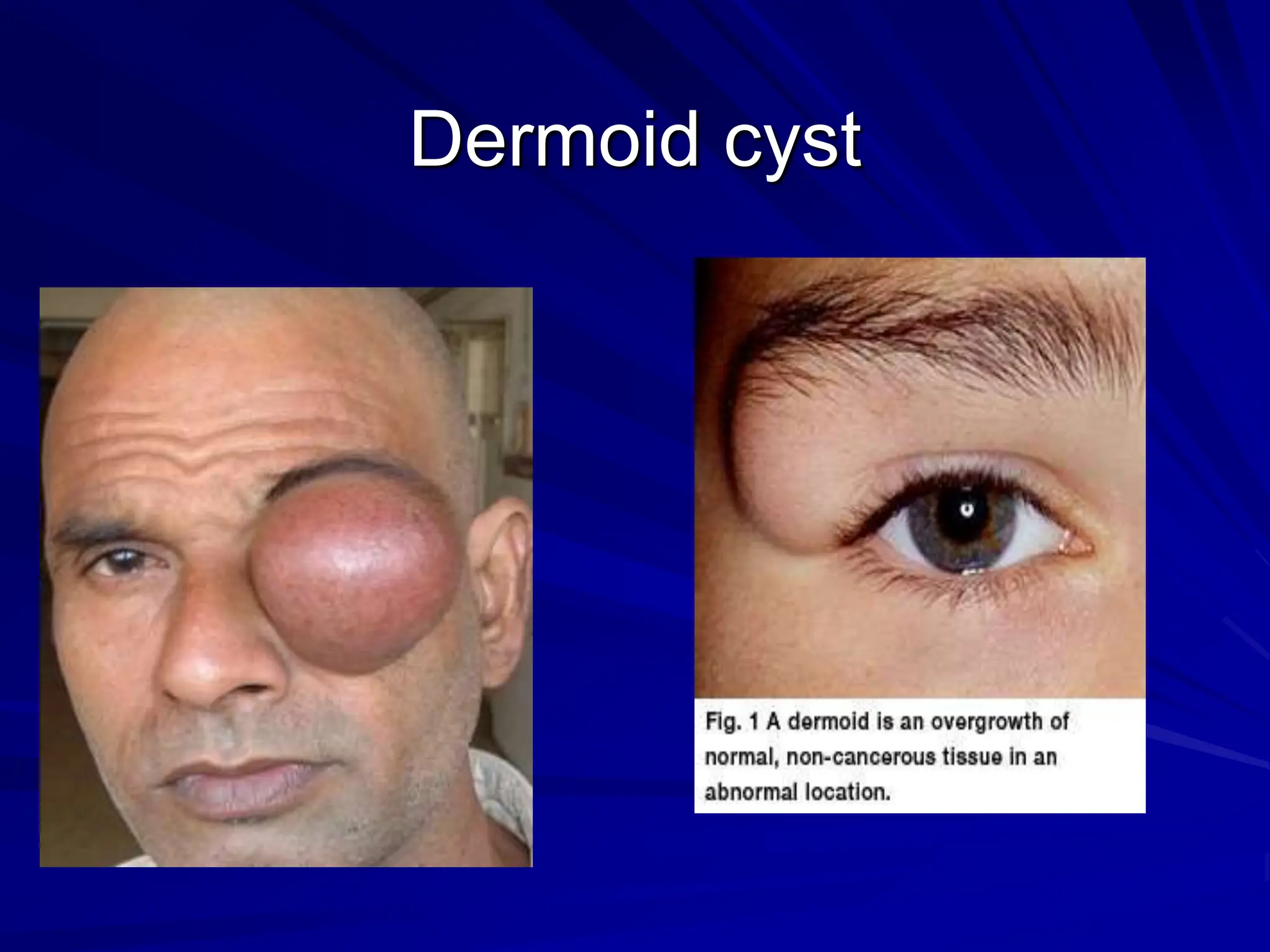 skin conditions with normal skin anatomy and physiology. | PPT