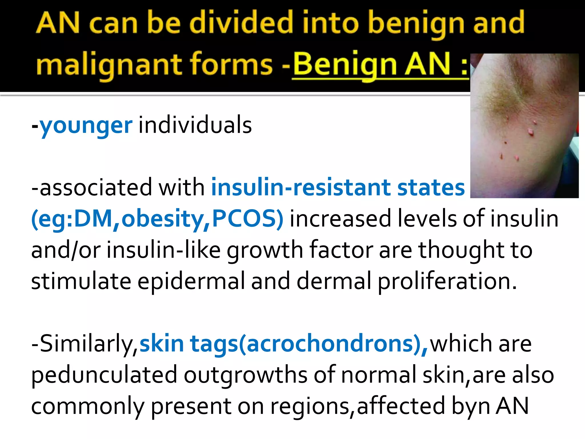 Skin condition associated with disease | PPTX