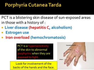 Skin condition associated with disease | PPTX
