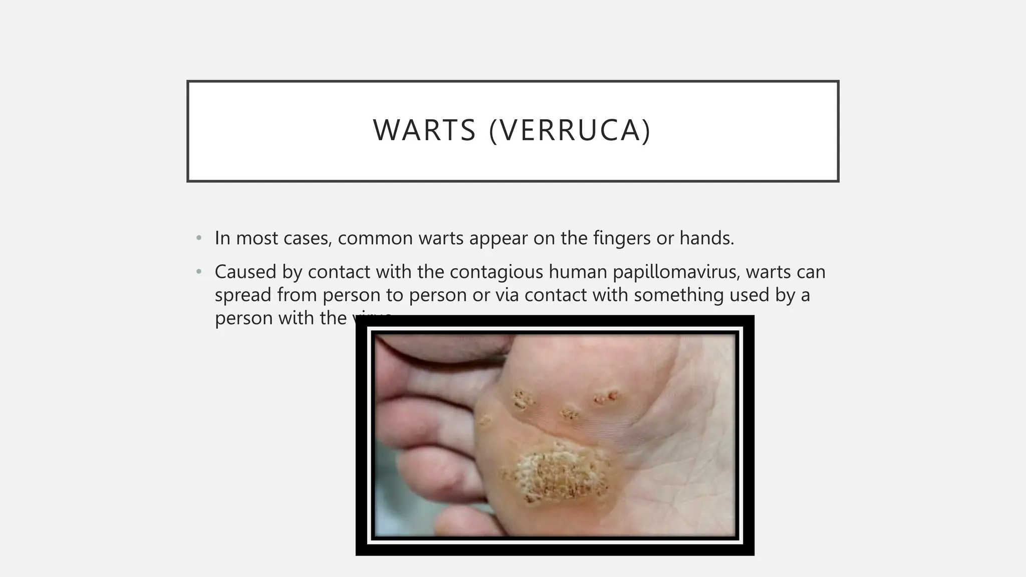 sKIN CONDITIONs.pptx