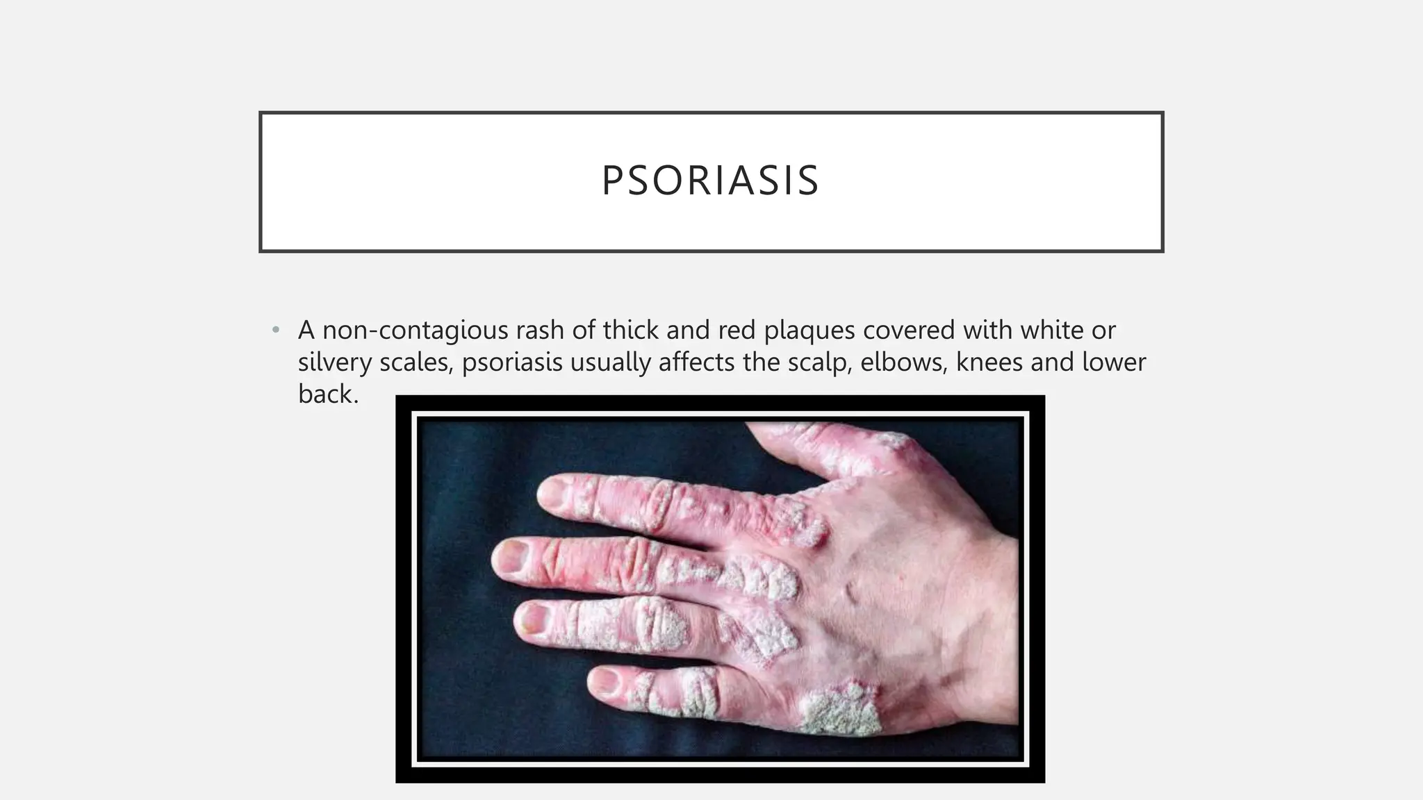 sKIN CONDITIONs.pptx