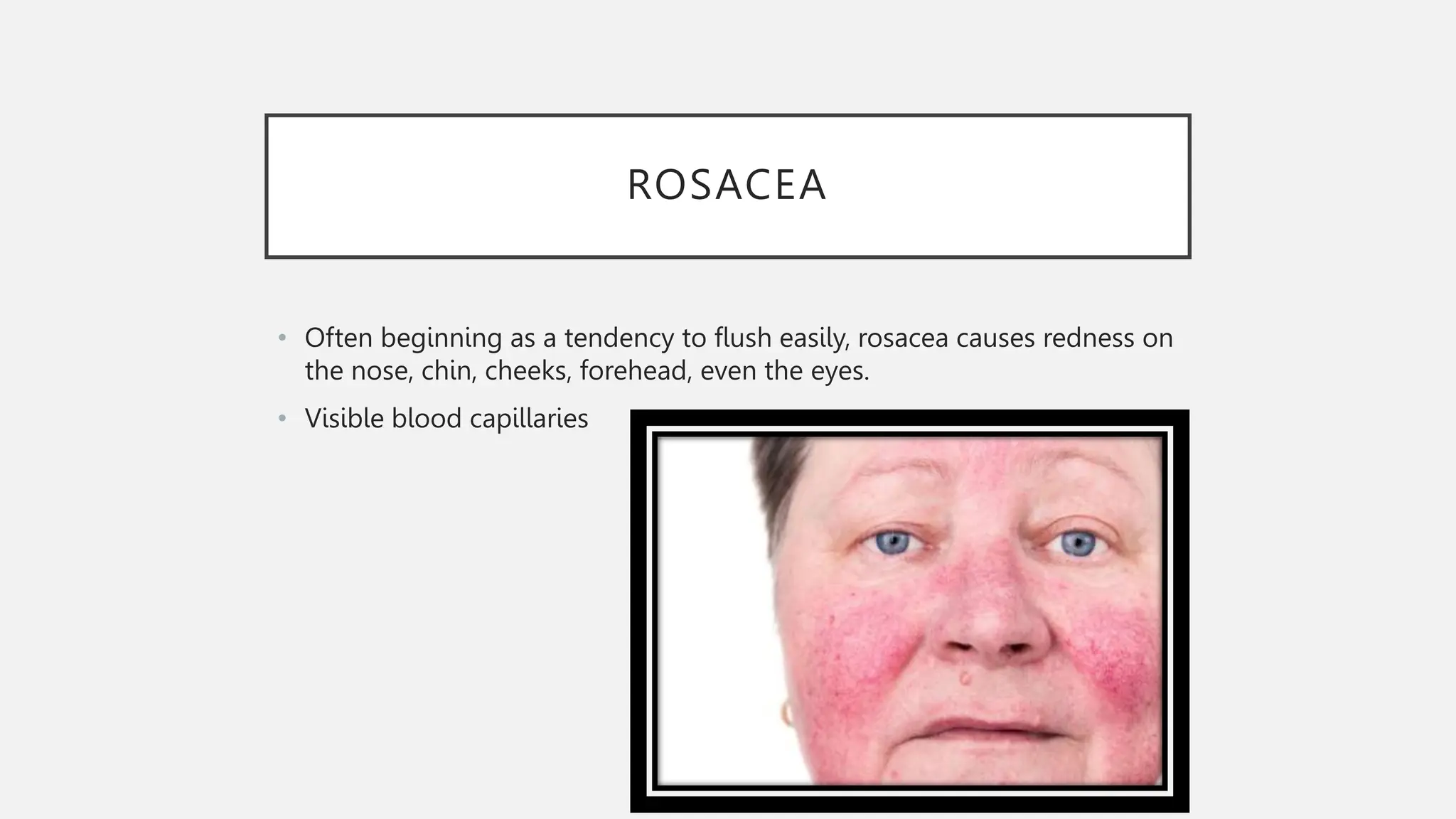 sKIN CONDITIONs.pptx