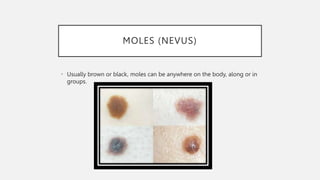sKIN CONDITIONs.pptx